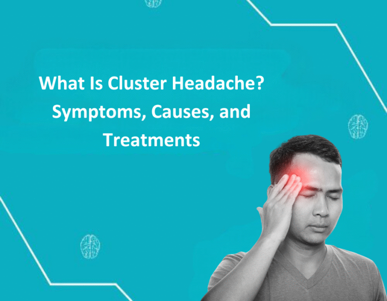 Cluster Headache: Symptoms, Causes and Treatment Guide